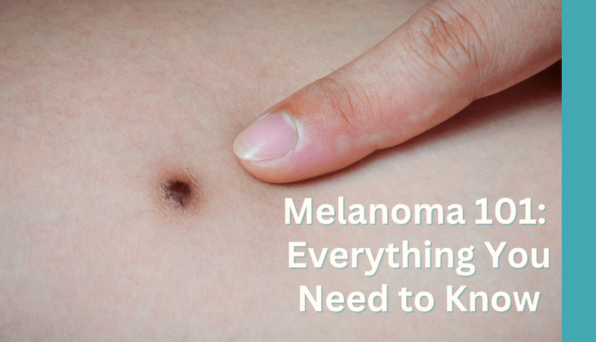 Melanoma 101 Everything You Need To Know Adf Dermatology